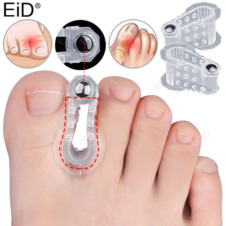 Magnet Orthopedic Foot Big Toe Straightener Hallux Valgus Bunion ...