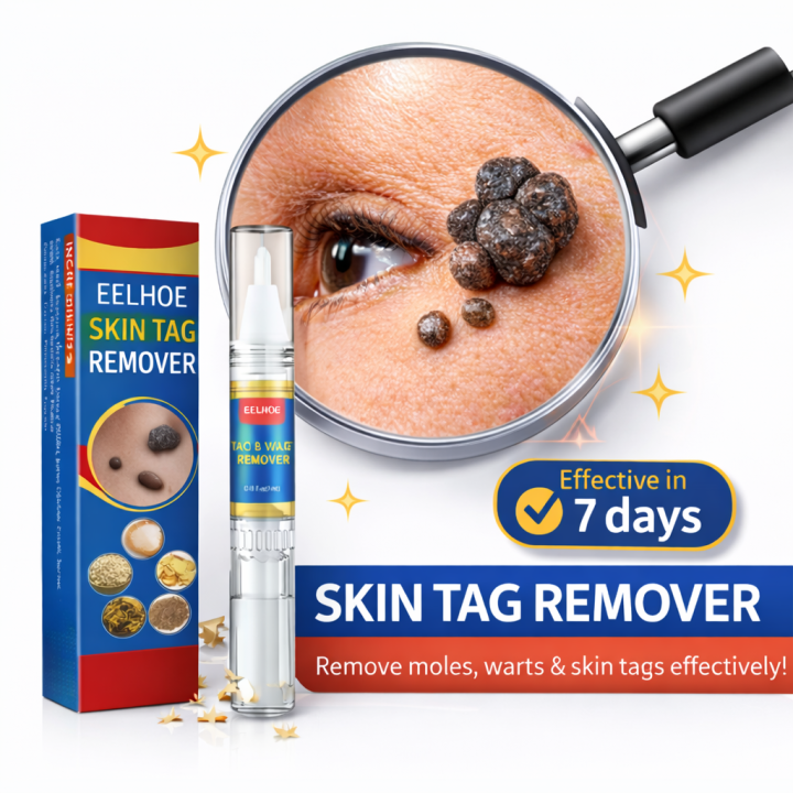 Skin Tag Remover Pen for Warts, Moles & Skin Tags – Safe & Easy Home ...