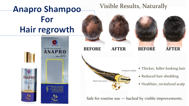 ANAPRO (Anti DHT Hair Fall Shampoo) | Re-Grow Hair, Reduce Hair Loss ...