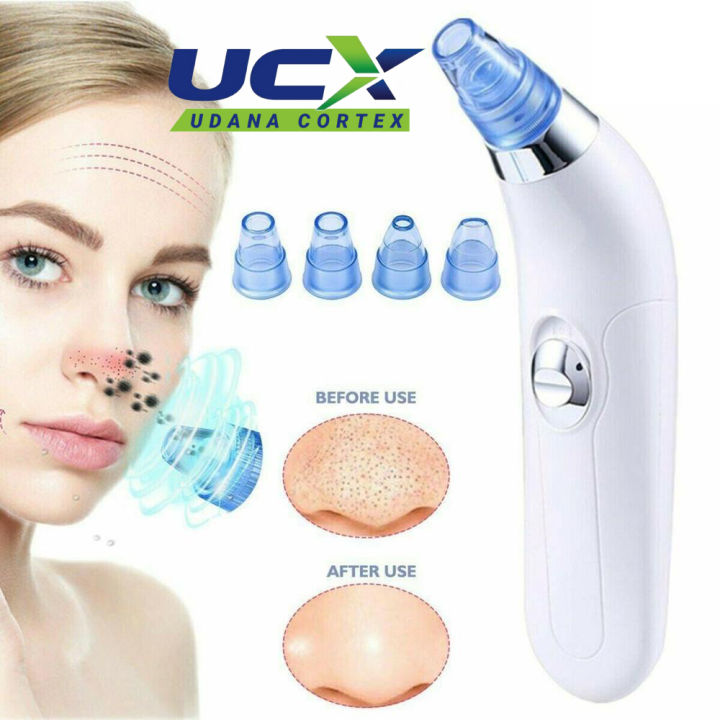 Udana Cortex Blackhead Removal Machine Derma Suction 4 In 1 Black Head ...