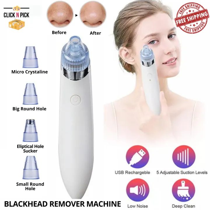 Derma Suction 5-in-1 Blackhead & Pimple Removal Device – Facial Vacuum ...