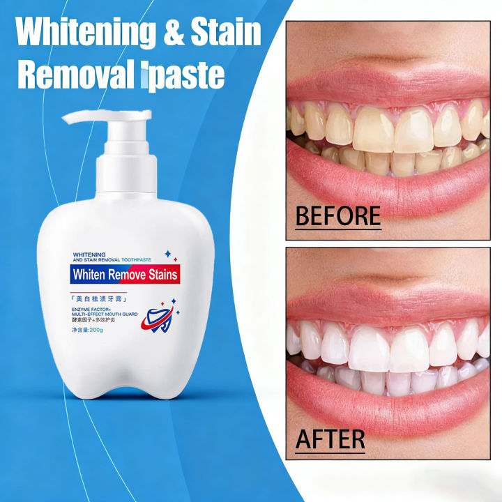 Toothpaste for Advanced toothpaste sensodyne Enamel Protection Tooth ...