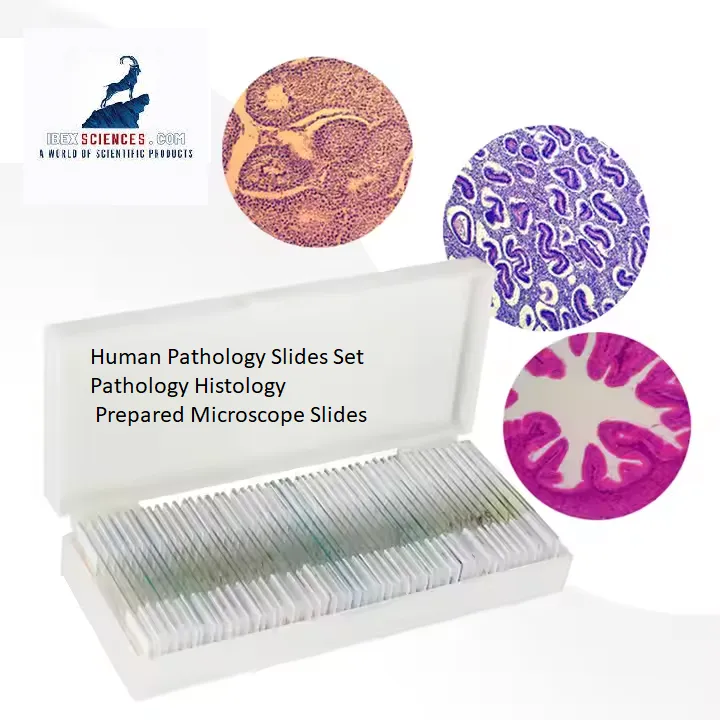 IBEX SCIENCES 50Pcs/Set Human Pathology Slides Set Pathology Histology ...