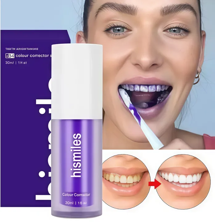 Original Hismile V34 Teeth Whitening | Purple Colour Corrector Serum ...
