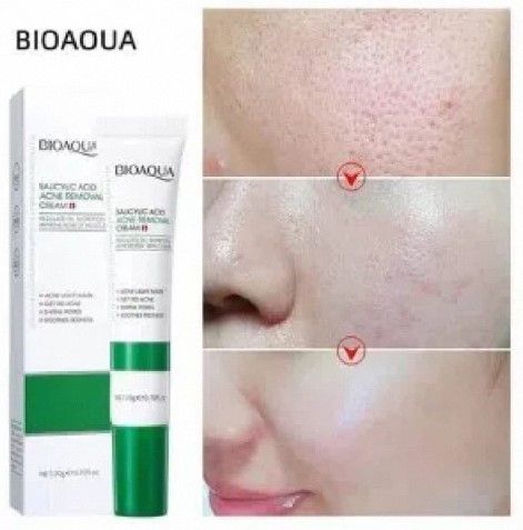 Bioaqua Salicylic Acid Acne Cream Pimple & Acne Treatment, Oil Control ...