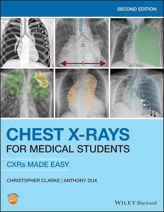 Chest XRays for Medical Students CXRs Made Easy 2nd Edition | Daraz.pk