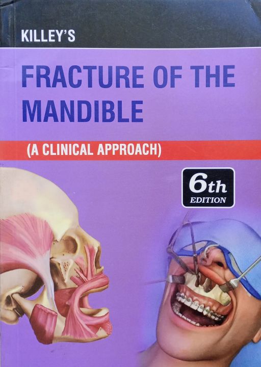 Killey's Fracture of the Mandible A Clinical Approach 6th Edition Best ...