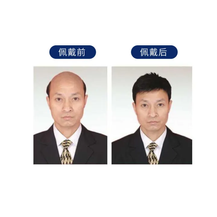 Wig short top head balding, front of forehead men, real hair patch for ...