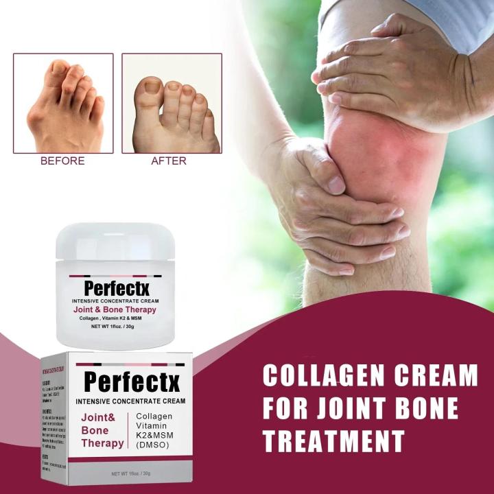 Perfectx Collagen Tenosynovitis Treatment Ointment No Box Treatment Of ...