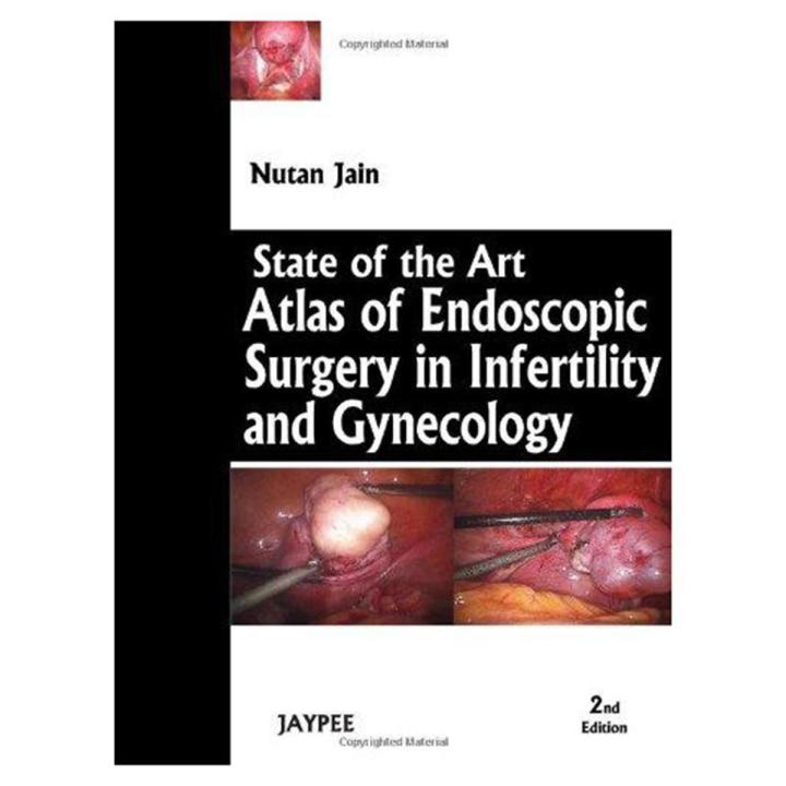 State Of The Art Atlas Of Endoscopic Surgery In Infertility And ...