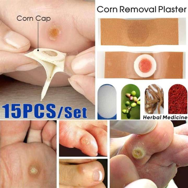Foot & Hand Corn Removal Calluses Plantar Warts First aid kit Thorn ...