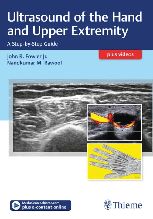 Ultrasound of the Hand and Upper Extremity A Step By Step Guide | Daraz.pk