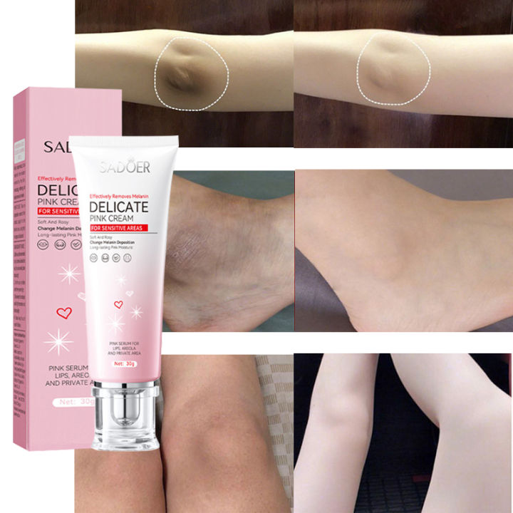 Calee 2pcs Whitening Body Cream Lighten Melanin Pink Underarm Knees ...