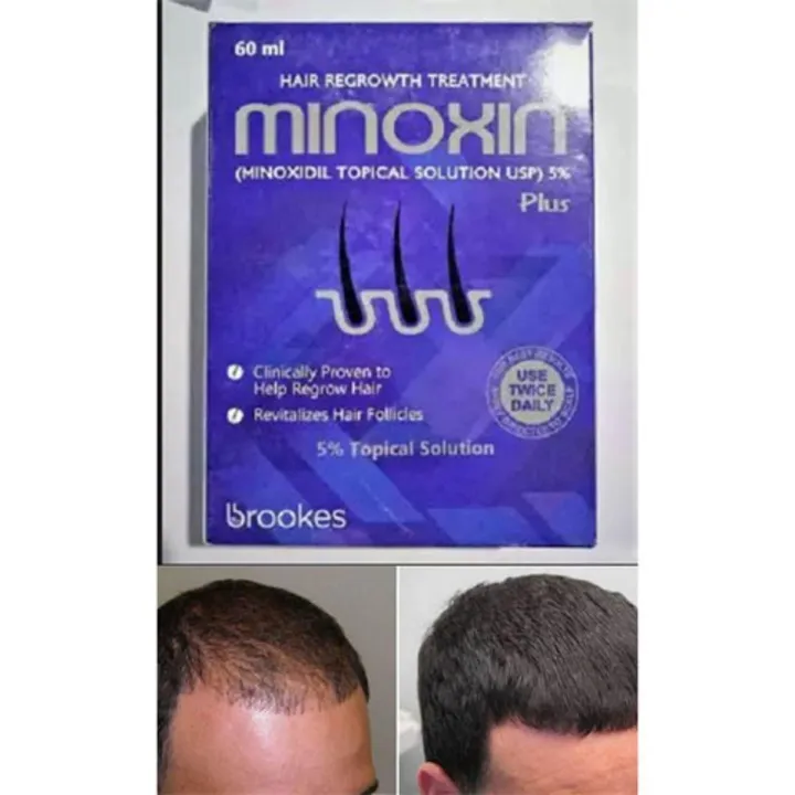 100% Hair Regrowth Minoxi Tropical Solution 5% 60ml in pakistan | Daraz.pk