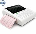 ECG Roll 80mm x 20m | Medical ECG Thermal Paper Roll High Quality ECG ...