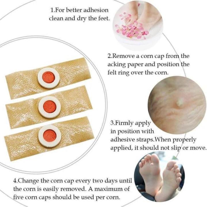 Foot & Hand Corn Removal Calluses Plantar Warts Thorn Pain Relief ...