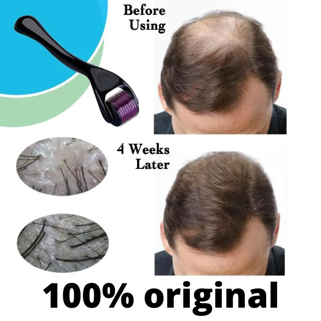DERMA ROLLER 0.5 MM HAIR AND SKIN SYSTEM - BEST QUALITY DERMA ROLLER ...