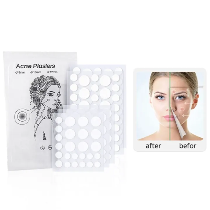 New Artificial Skin Acne Removal Patch Transparent Invisible Pimple ...