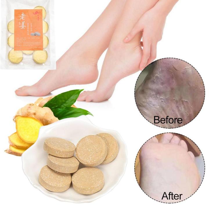 10PCS/Bag Effective Psoriasis Beriberi Health Care Foot Cracking ...