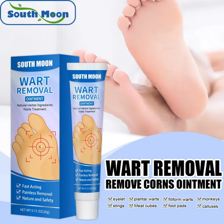 South Moon Corn Removal Treatment Cream Natural Plants Skin Wart ...