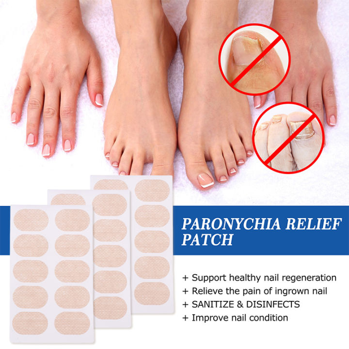10pcs Nail Correction Stickers Ingrown Toenail Onychomycosis Repair ...