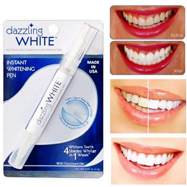 Teeth Whitening Pen | Stain Removing Teeth Whitening | Remove Plaque ...