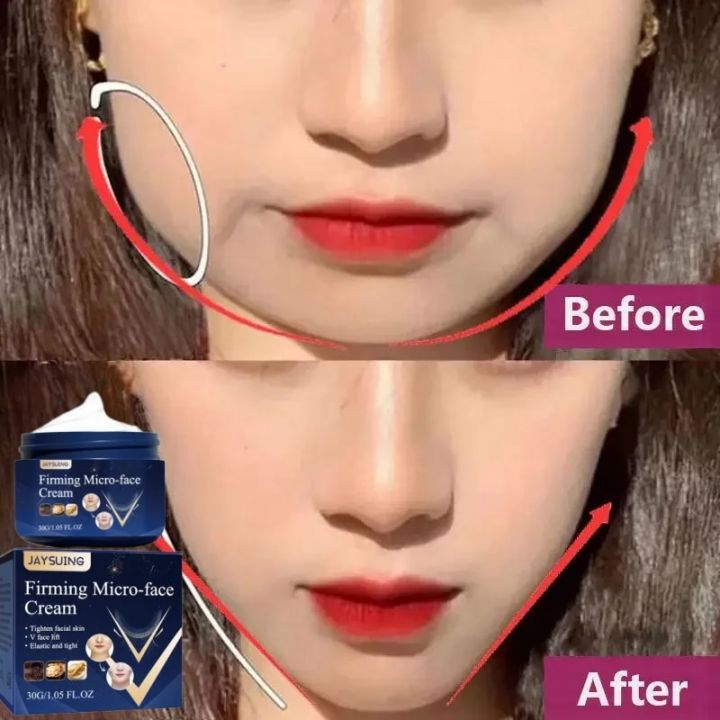 Lethe Ling Effective Face V Shape Lift Slim Cream Remove Double Chin ...