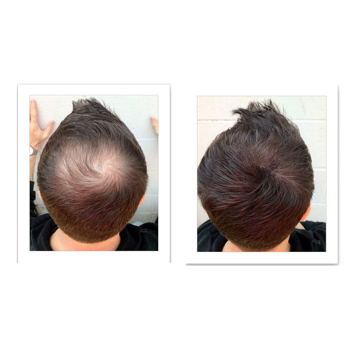 Pack of 2 Caboci Hair Building Fiber – Instant Hair Thickening Powder ...