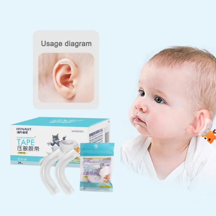 Baby Auricle Support External Auricle Corrector Protruding Baby Ear ...