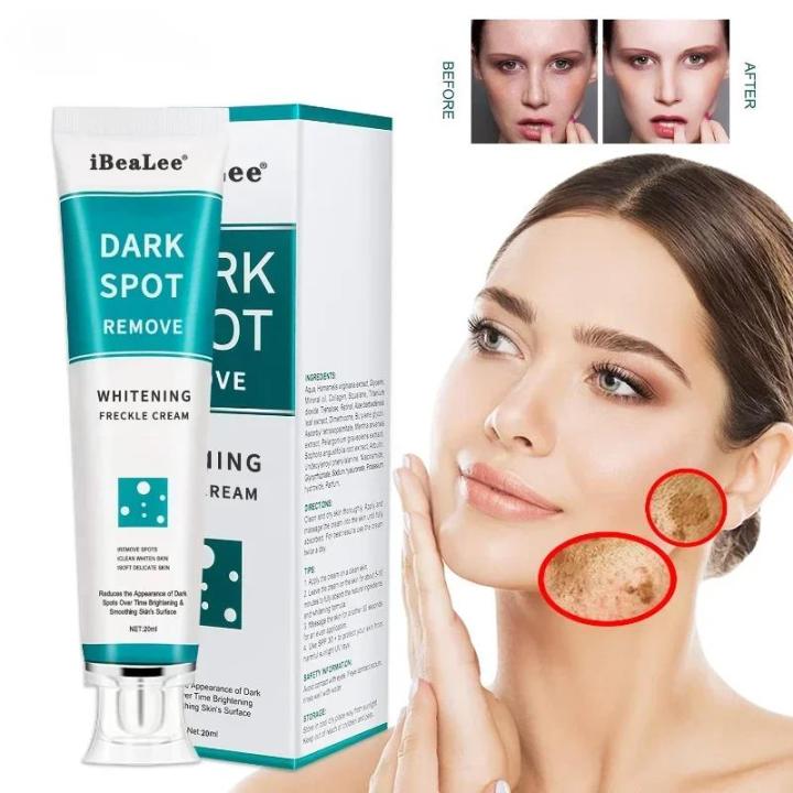 Whitening Freckles Cream Remove Melasma Dark Spots Lighten Melanin Remover Moisturizing ...