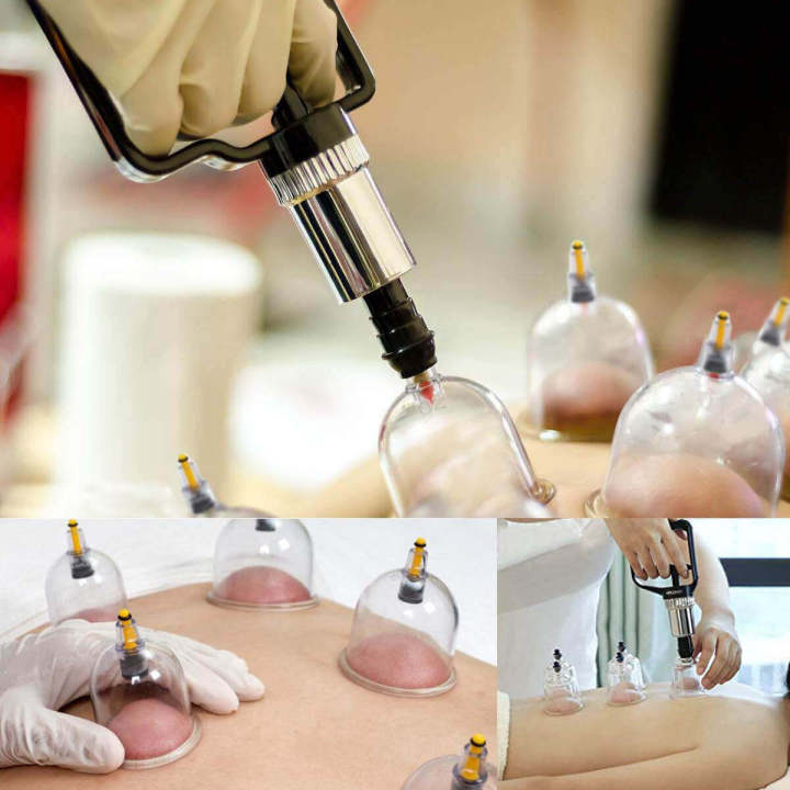 Hijama complete kit 36 cup 2 pump set | Daraz.pk