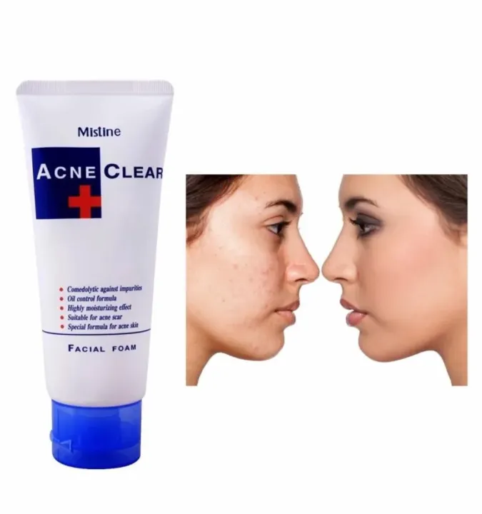 Mistine Acne Clear Face Wash Facial Foam 85 ml | Daraz.pk
