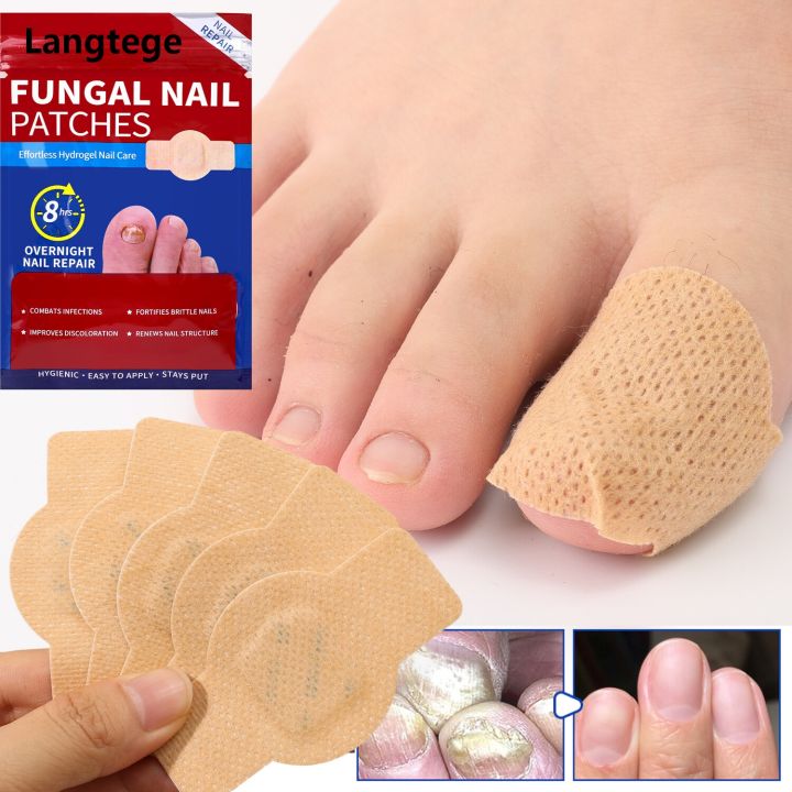 Langtege 【XZ Beauty】Fungal Nail Patches 21pcs Gently Repair Nails ...