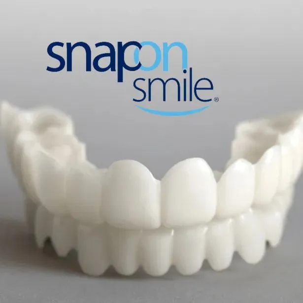 Snap-On Smile Veneers for Upper & Lower Teeth – Transparent Braces ...