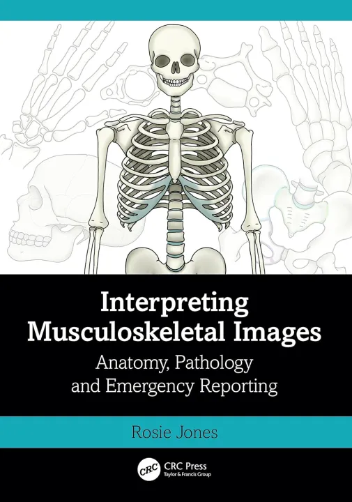 Interpreting Musculoskeletal Images Anatomy Pathology and Emergency ...